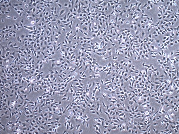 TC28a2 Human Chondrocyte Cell Line | SCC042